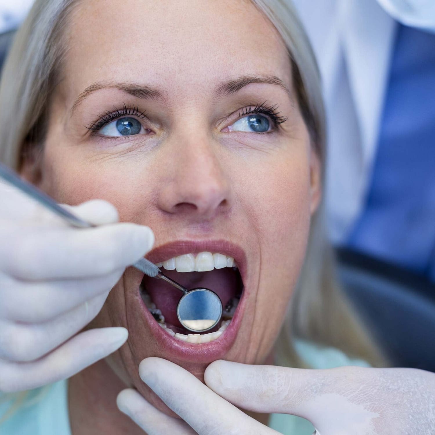 General Dentistry In Hitchin - No.1 High street Dental Practice